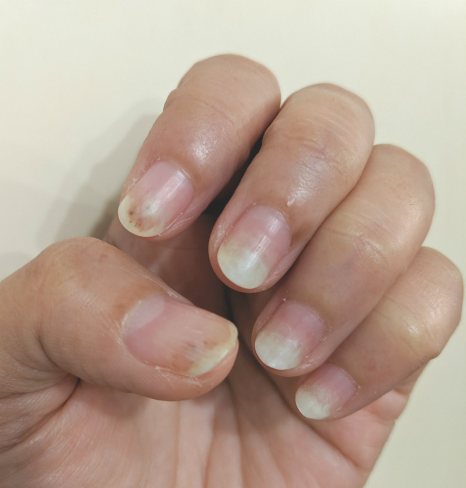 119 足の「小指の爪」 大人になり小さくなる理由とは？｜紫光【SHIKO】遠隔透視鑑定士｜coconalaブログ