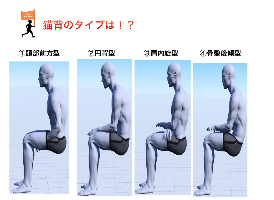 あなたの猫背は何タイプ！？｜藤PT｜coconalaブログ