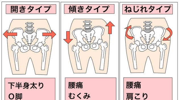 3児のパパトレーナー推奨！産後骨盤ダイエット編｜パーソナルトレーナーJTタク｜coconalaブログ